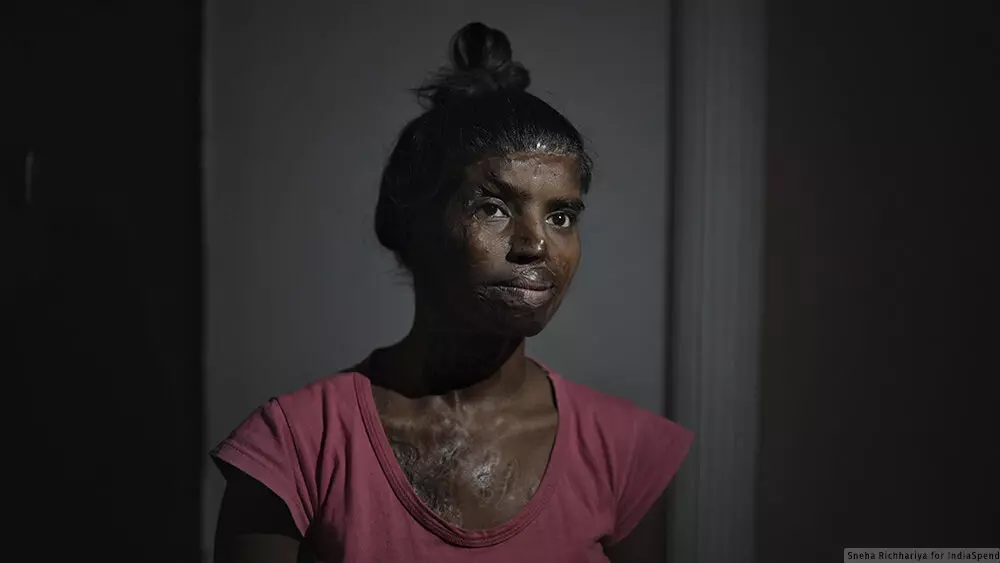 Scare of the Scars: Acid Attacks and Skin Scarring